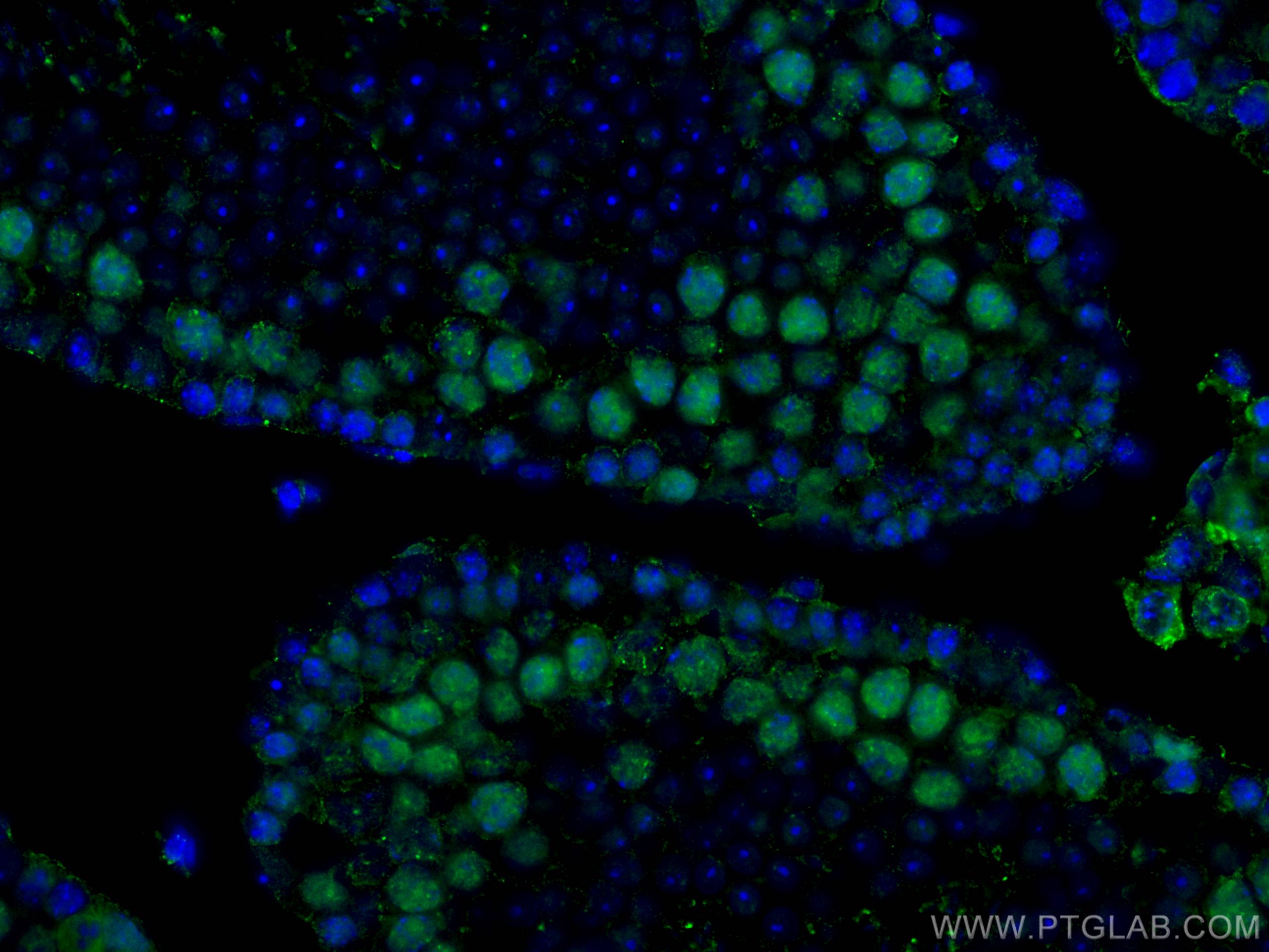 METTL3 Antibody 67733-1-Ig | Proteintech