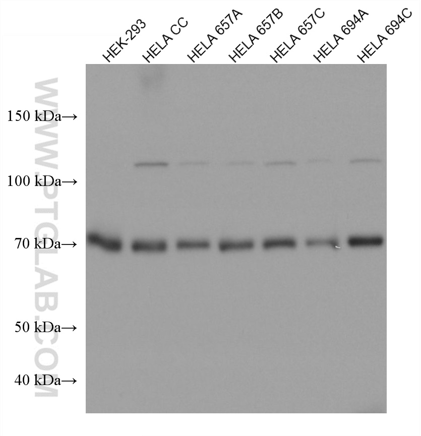METTL3 Fusion Protein Ag7110 | Proteintech