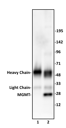 MGMT antibody (pAb) | Proteintech | 武汉三鹰生物技术有限公司