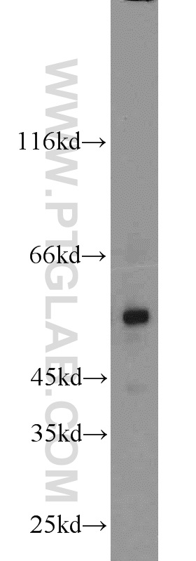 MLYCD antibody (15265-1-AP) | Proteintech | 武汉三鹰生物技术有限公司