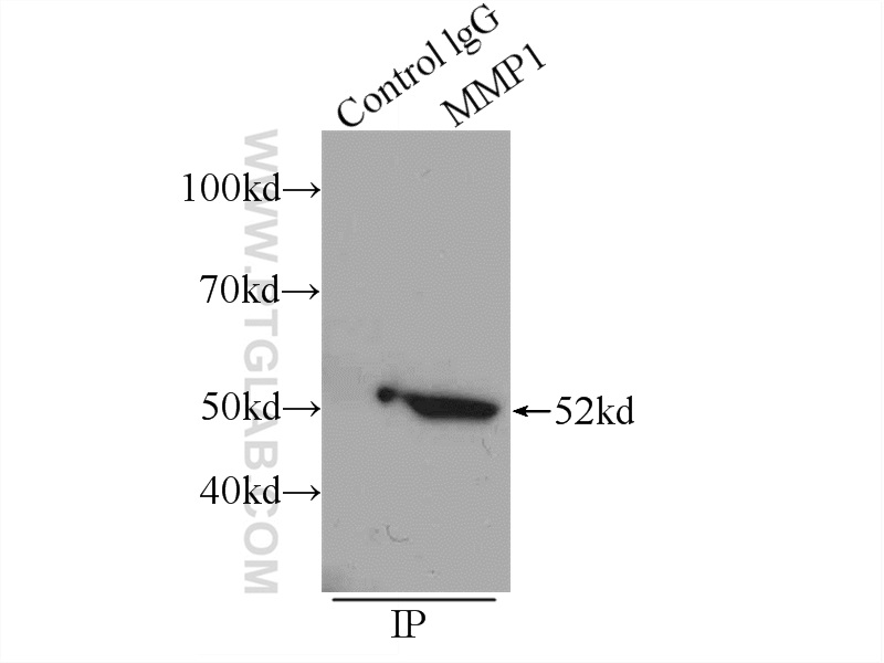 Collagen Type III (C-terminal) antibody (13548-1-AP) | Proteintech | 武汉 ...