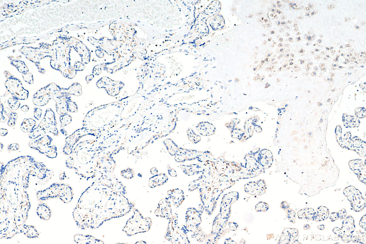CD206 antibody (18704-1-AP) | Proteintech | 武汉三鹰生物技术有限公司