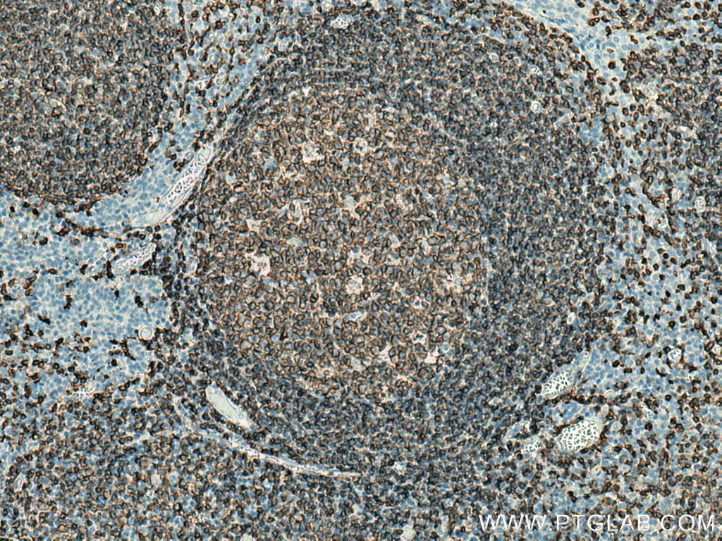 CD20 antibody (24828-1-AP) | Proteintech | 武汉三鹰生物技术有限公司