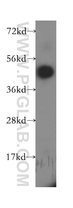 MS4A6A antibody (11930-1-AP) | Proteintech | 武汉三鹰生物技术有限公司