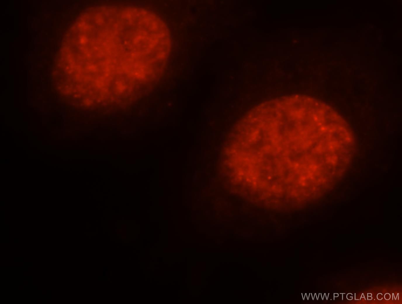 MSH2 Antibody 15520-1-AP | Proteintech