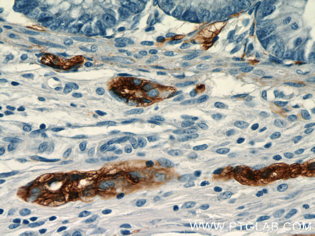 NCAM1/CD56 antibody (14255-1-AP) | Proteintech | 武汉三鹰生物技术有限公司