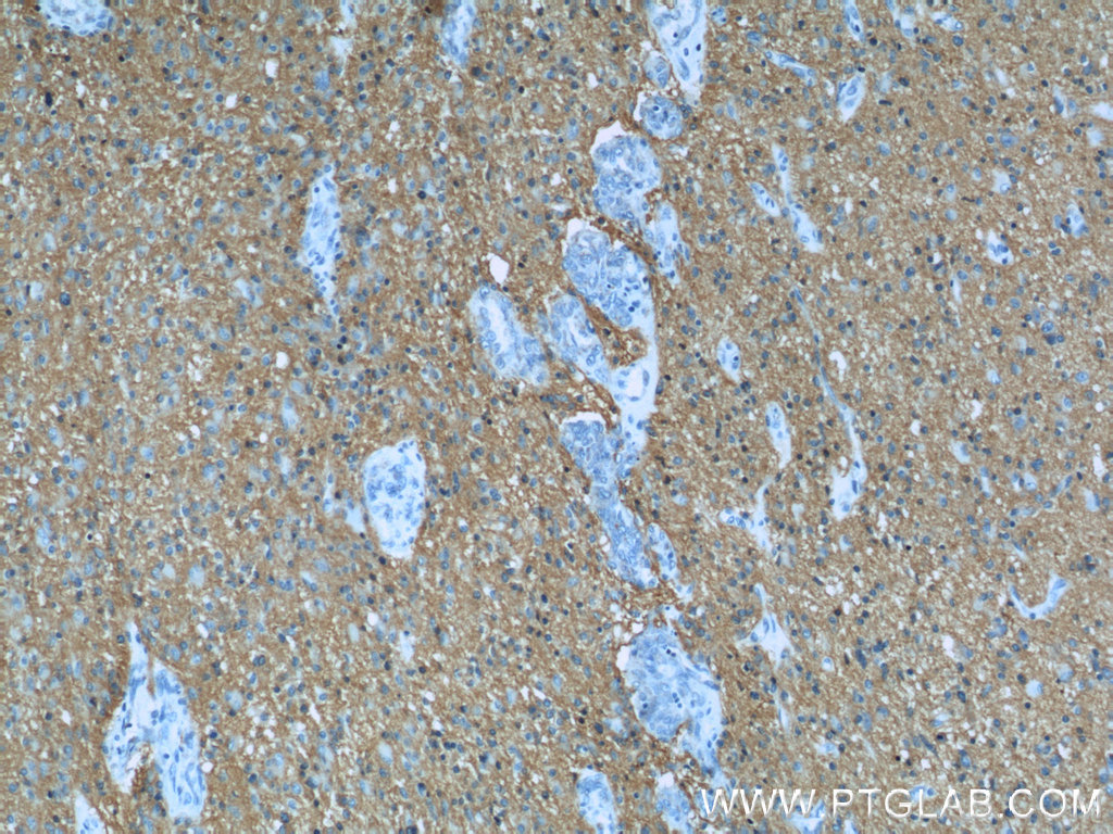 NCAM1/CD56 antibody (14255-1-AP) | Proteintech | 武汉三鹰生物技术有限公司