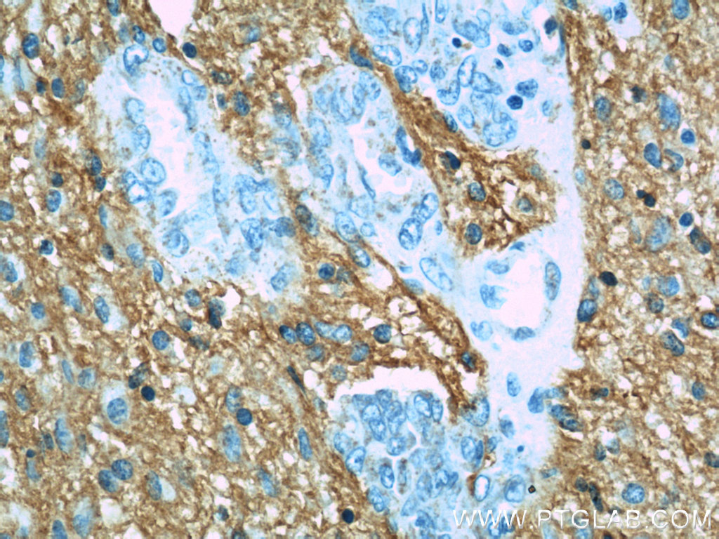 NCAM1/CD56 antibody (14255-1-AP) | Proteintech | 武汉三鹰生物技术有限公司