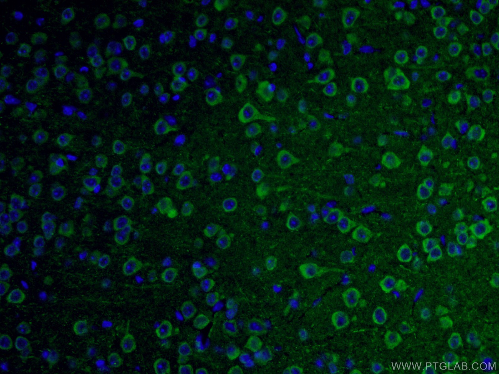 NF-H/NF200 antibody (18934-1-AP) | Proteintech | 武汉三鹰生物技术有限公司