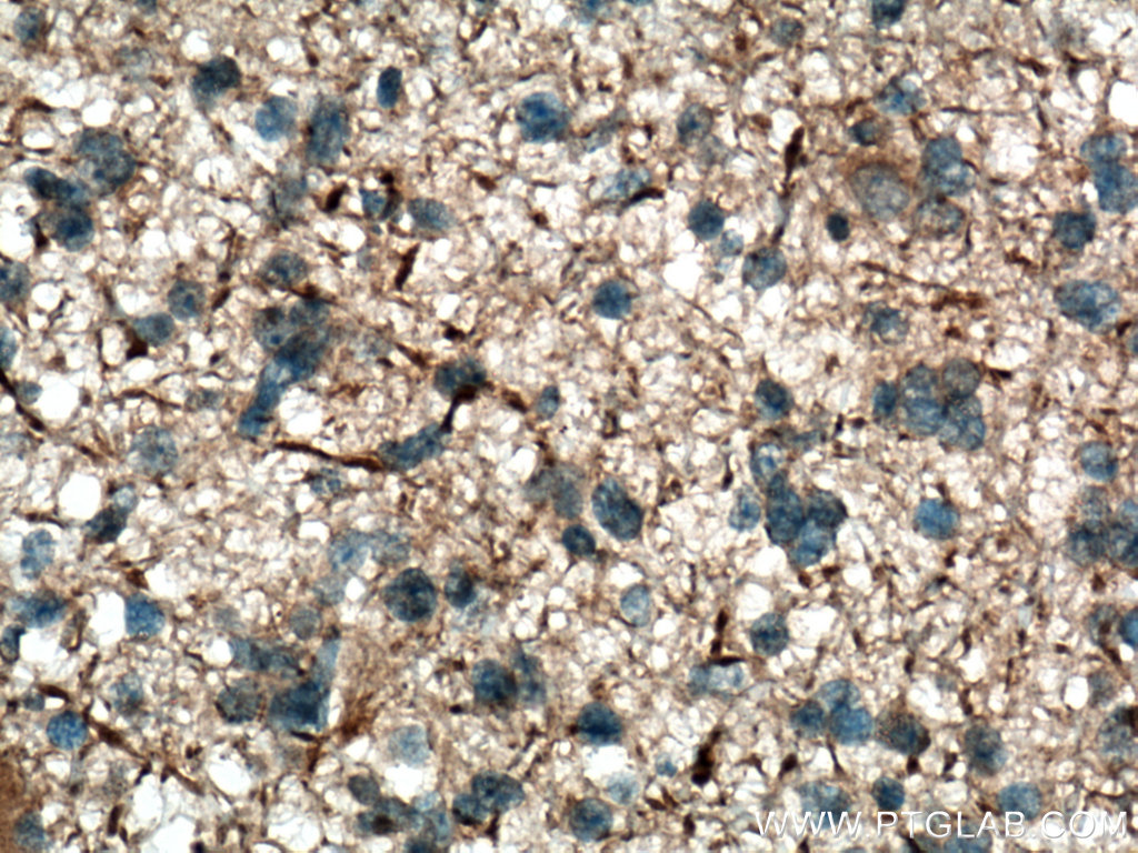 NF-H/NF200 antibody (18934-1-AP) | Proteintech