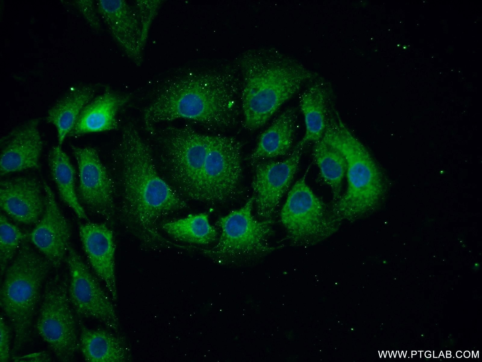 NF-L Antibody 12998-1-AP | Proteintech