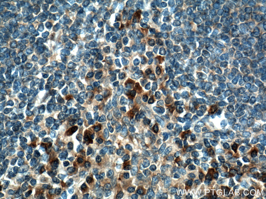 NLRP3 Fusion Protein Ag26289 | Proteintech | 武汉三鹰生物技术有限公司