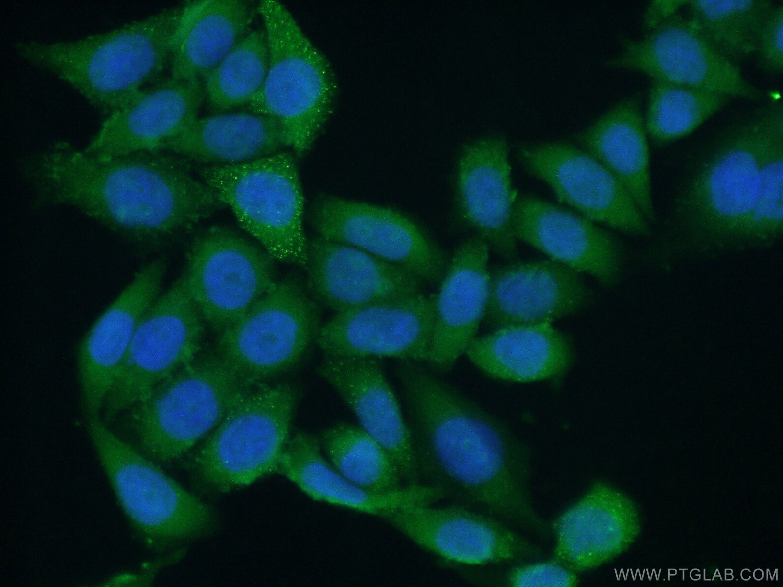 NMD3 antibody (16060-1-AP) | Proteintech | 武汉三鹰生物技术有限公司