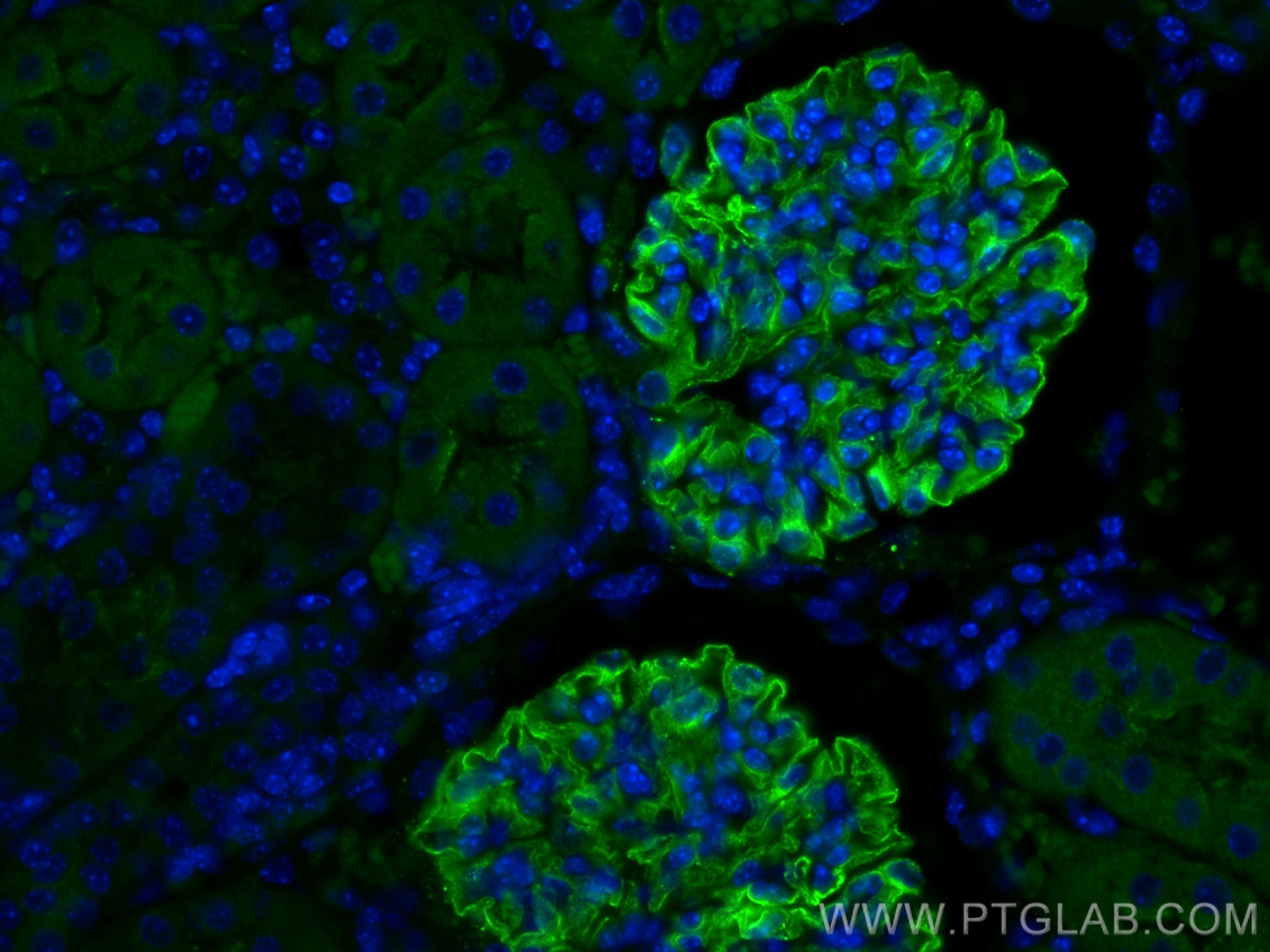 NPHS2 antibody (20384-1-AP) | Proteintech | 武汉三鹰生物技术有限公司