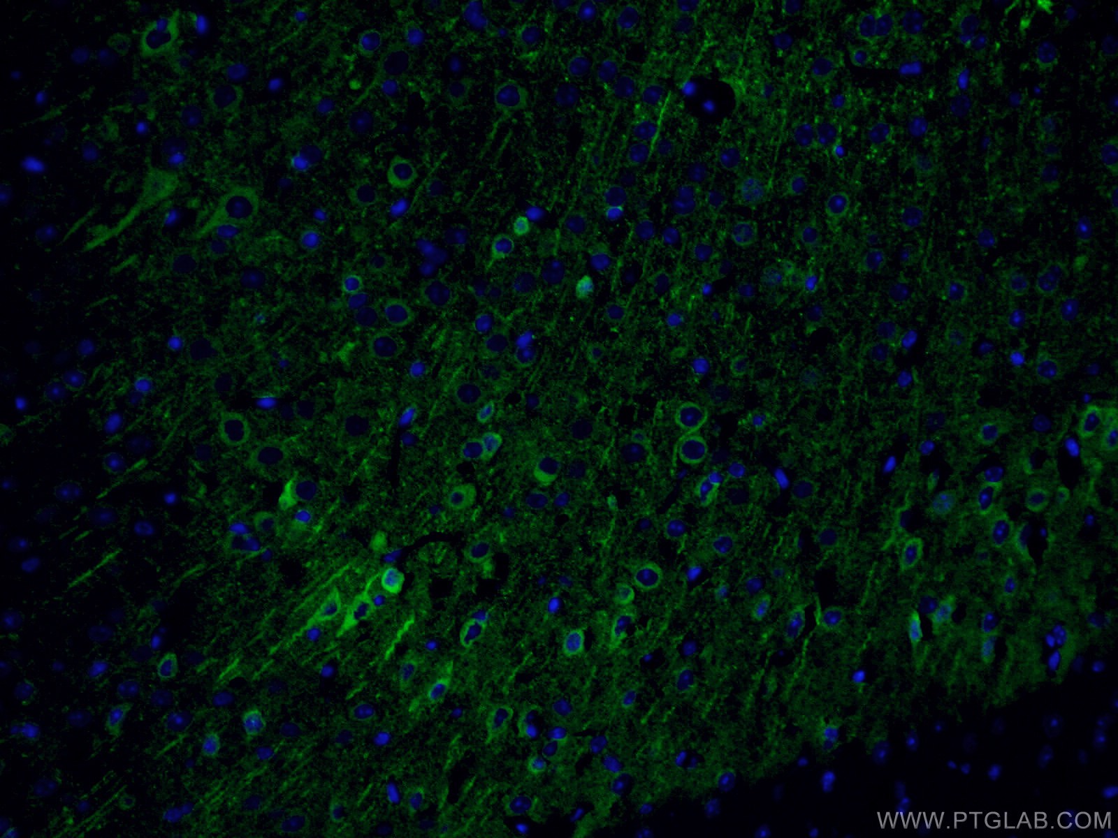 NSE antibody (CL488-66150) | Proteintech | 武汉三鹰生物技术有限公司