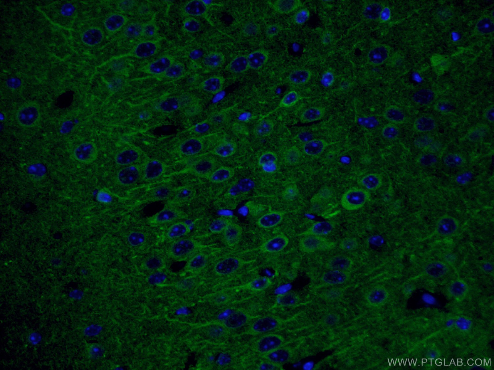 NSE antibody (CL488-66150) | Proteintech | 武汉三鹰生物技术有限公司