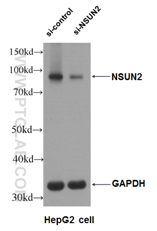 NSUN2 Antibody 20854-1-AP | Proteintech