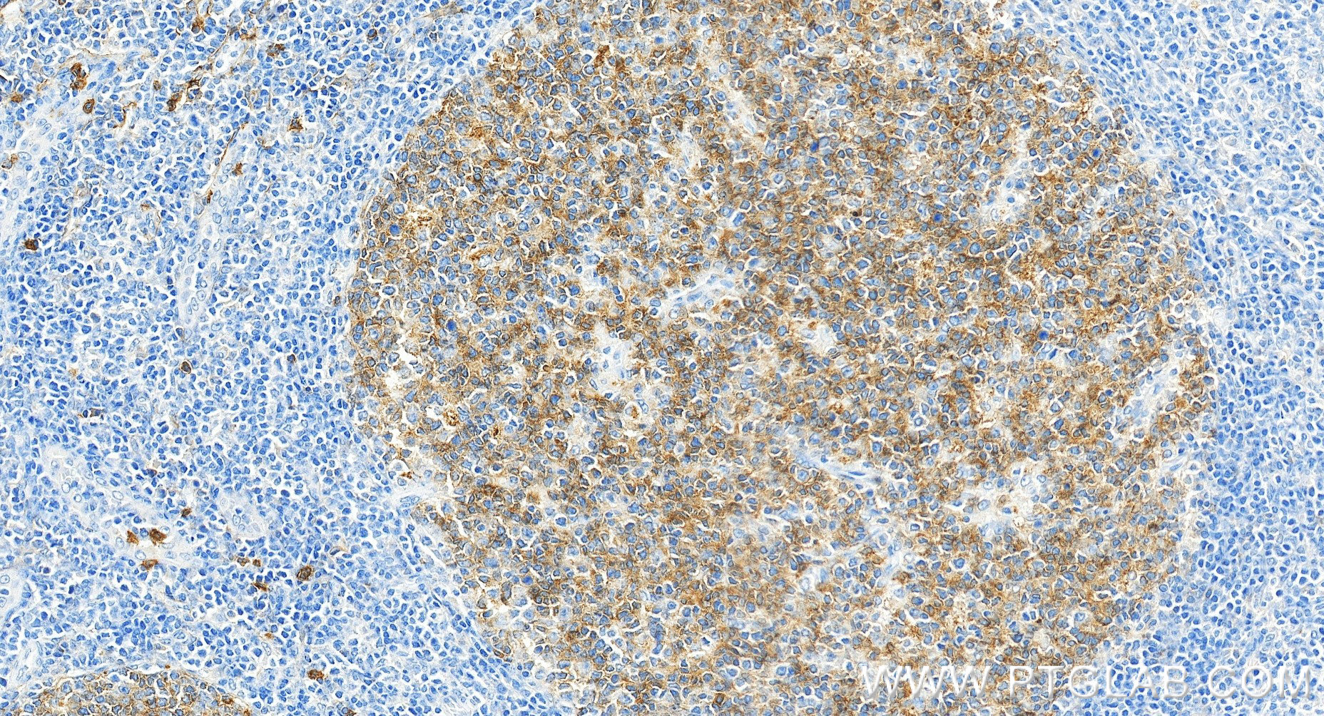 Neprilysin/CD10 antibody (84181-5-PBS) | Proteintech | 武汉三鹰生物技术有限公司