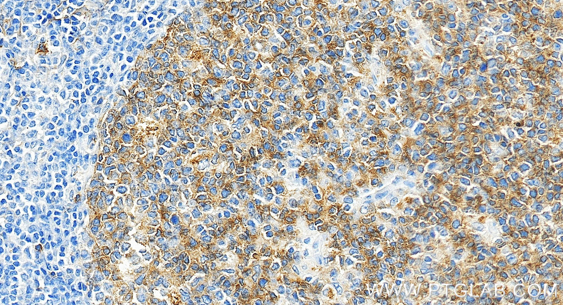Neprilysin/CD10 antibody (84181-5-PBS) | Proteintech | 武汉三鹰生物技术有限公司
