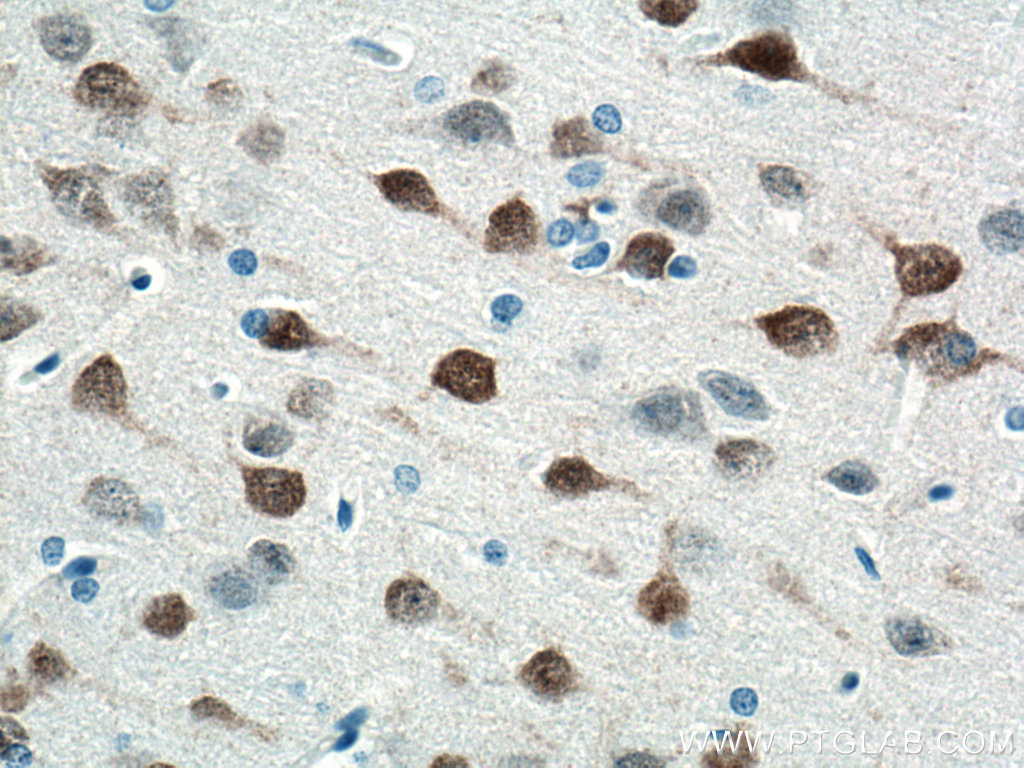 NeuN antibody (66836-1-Ig) | Proteintech | 武汉三鹰生物技术有限公司