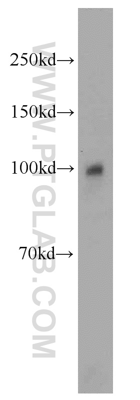 OAS3 antibody (21915-1-AP) | Proteintech | 武汉三鹰生物技术有限公司