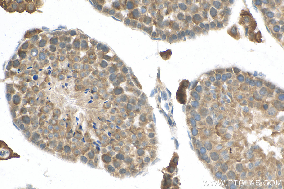 Osteocalcin antibody (23418-1-AP) | Proteintech | 武汉三鹰生物技术有限公司