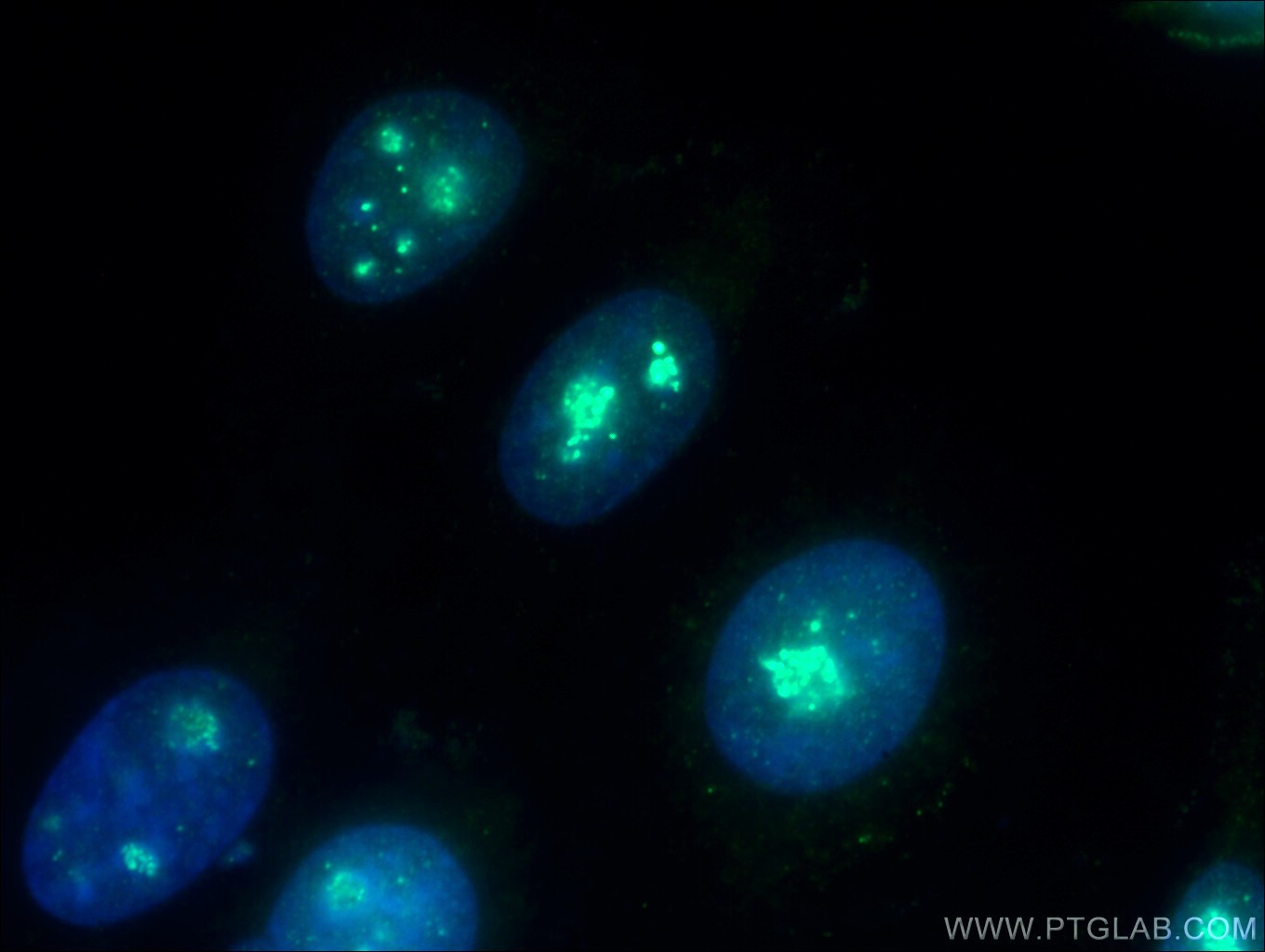 NOLC1 antibody (11815-1-AP) | Proteintech | 武汉三鹰生物技术有限公司