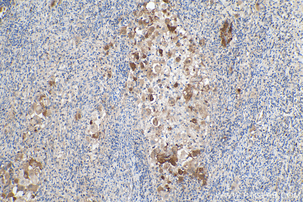 P16-INK4A antibody (10883-1-AP) | Proteintech | 武汉三鹰生物技术有限公司