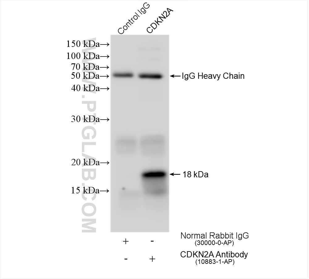 P16-INK4A antibody (10883-1-AP) | Proteintech | 武汉三鹰生物技术有限公司