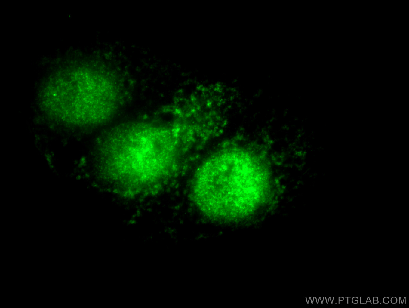 P21 antibody (10355-1-AP) | Proteintech | 武汉三鹰生物技术有限公司