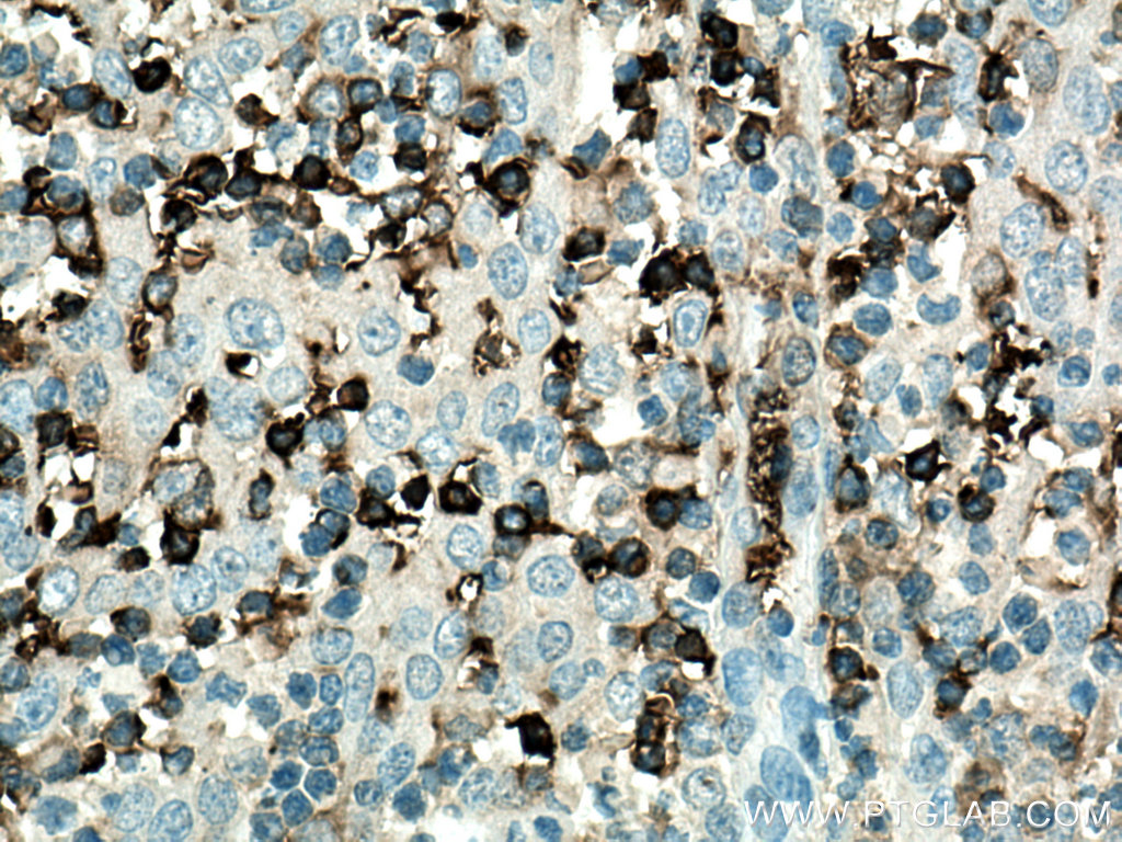 P2RX7 antibody (28207-1-AP) | Proteintech