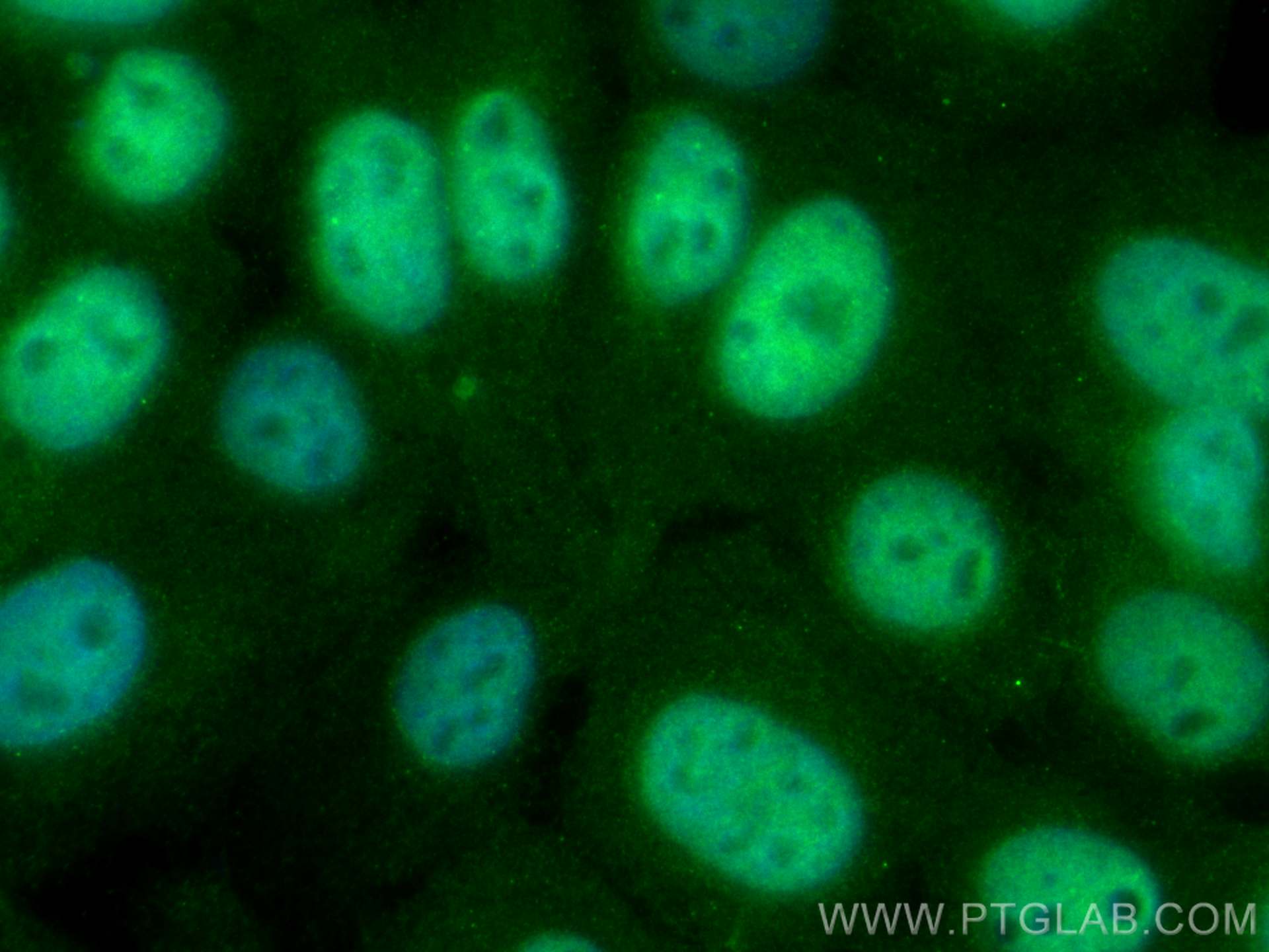 P53 antibody (60283-2-Ig) | Proteintech | 武汉三鹰生物技术有限公司