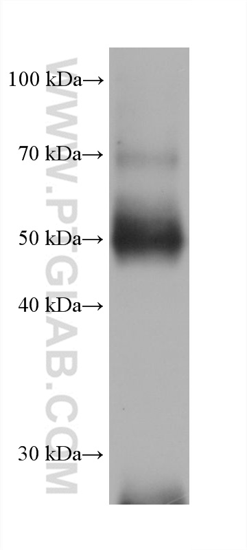 P53 antibody (60283-2-Ig) | Proteintech | 武汉三鹰生物技术有限公司