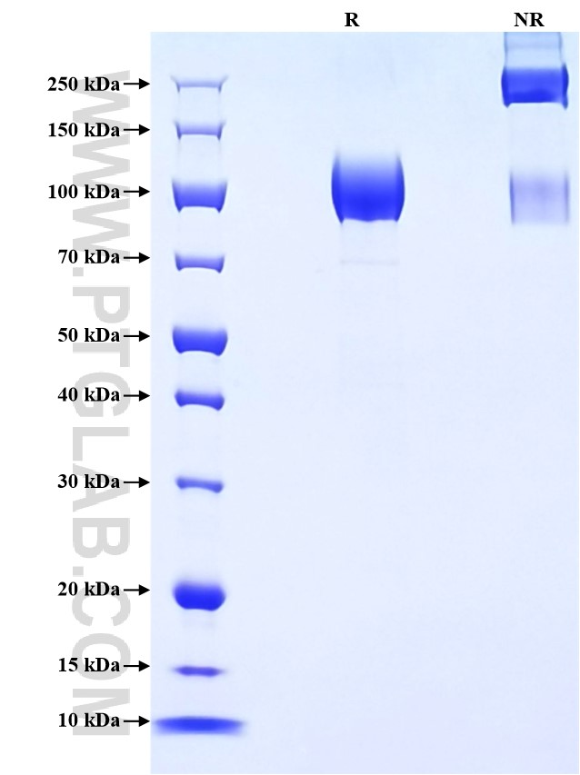 Recombinant Human CD117/c-kit protein (rFc Tag) | Proteintech | 武汉三鹰生物 ...