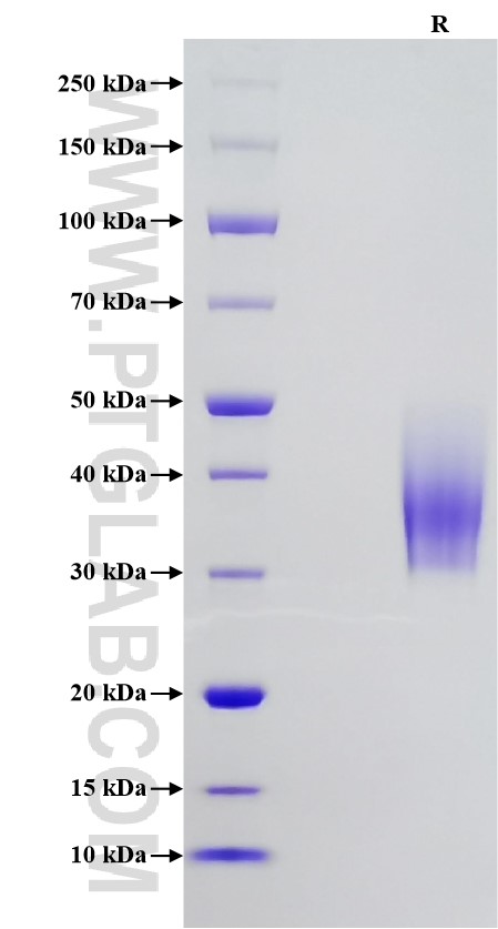 Recombinant Human PD-1 protein (Myc Tag, His Tag) | Proteintech | 武汉三鹰 ...