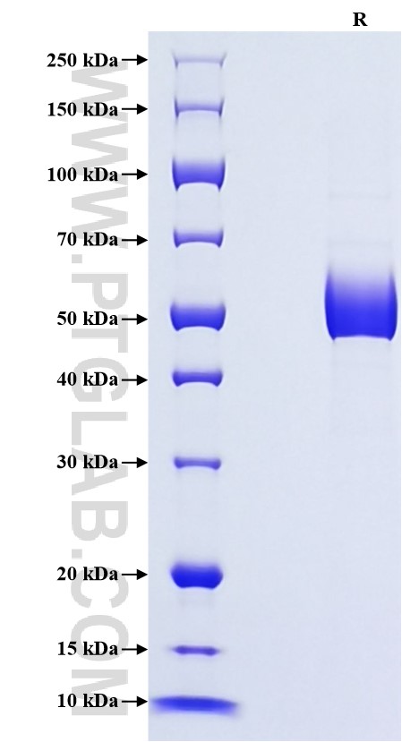 Recombinant Human Ferritin heavy chain/FTH1 protein (rFc Tag ...