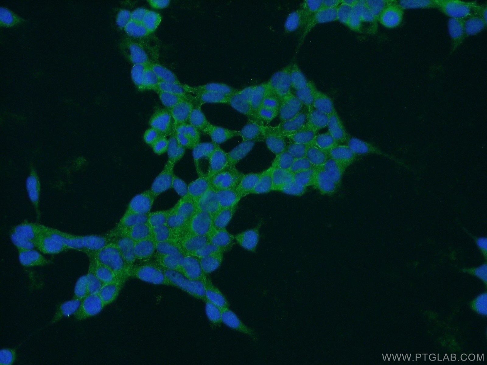 PAK6 antibody (13539-1-AP) | Proteintech | 武汉三鹰生物技术有限公司