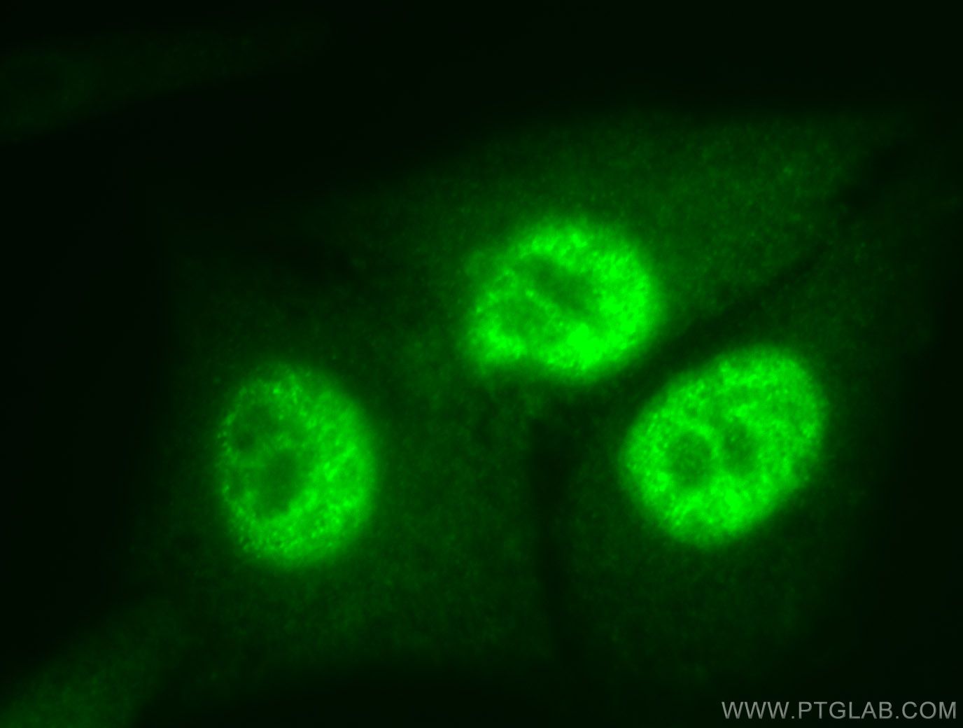 PCNA Antibody 10205-2-AP | Proteintech