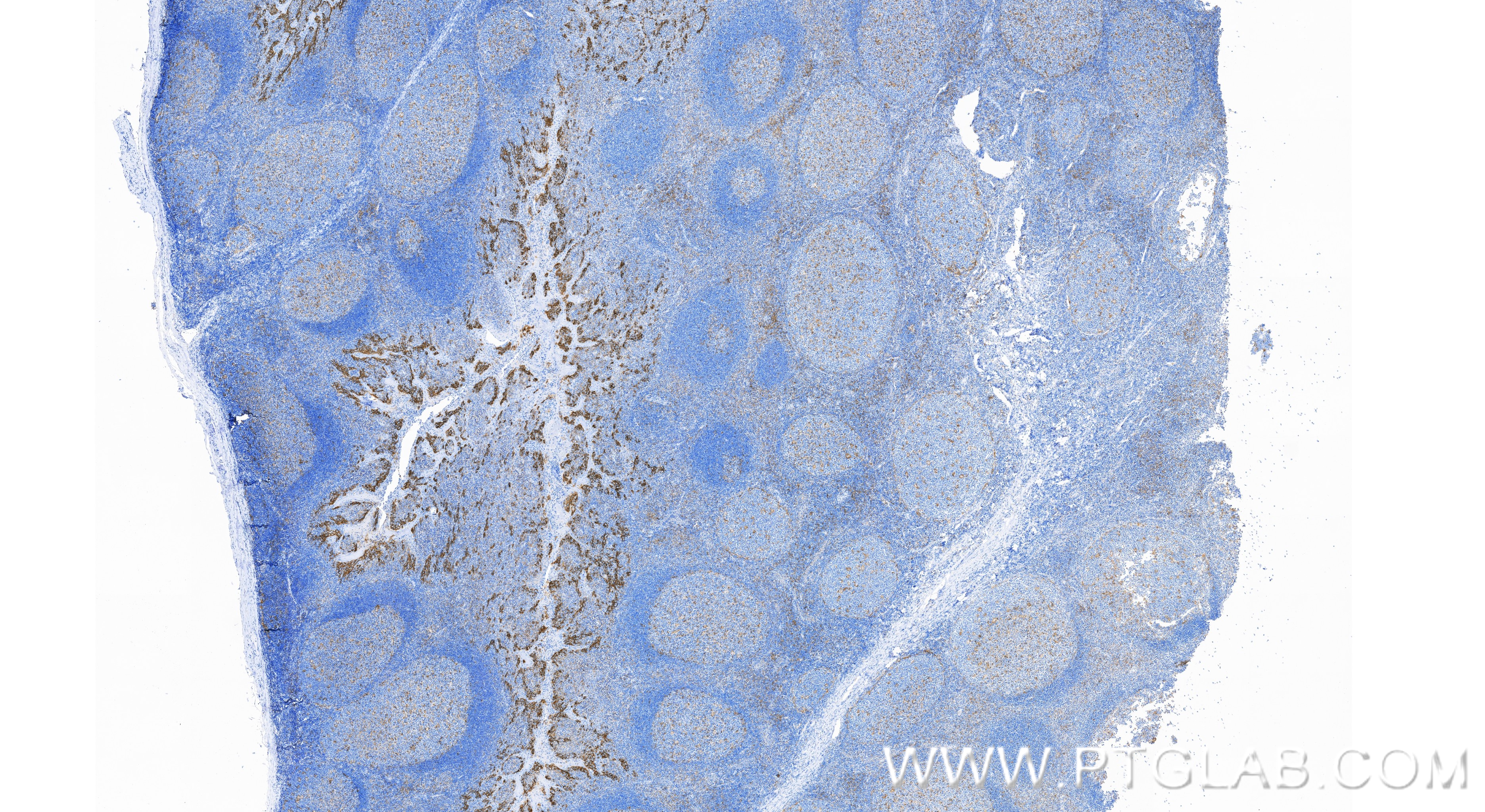 PD-L1/CD274 antibody (85229-23-RR) | Proteintech | 武汉三鹰生物技术有限公司