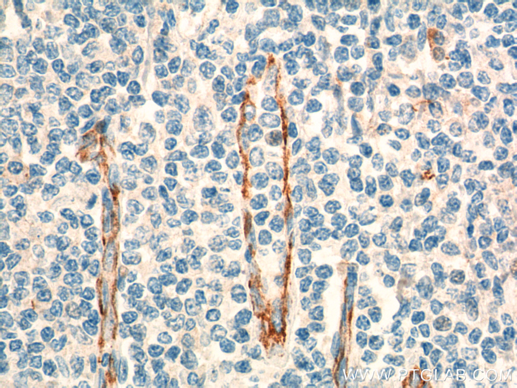 CD31 Antibody 66065-1-Ig | Proteintech