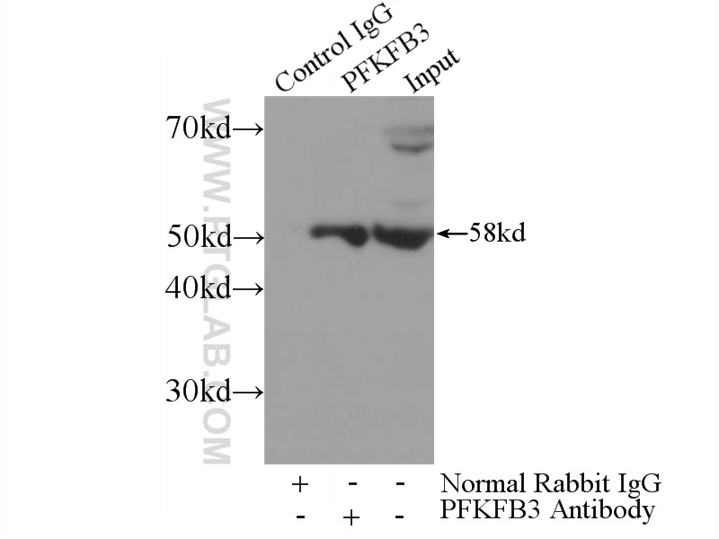 PFKFB3 antibody (13763-1-AP) | Proteintech | 武汉三鹰生物技术有限公司