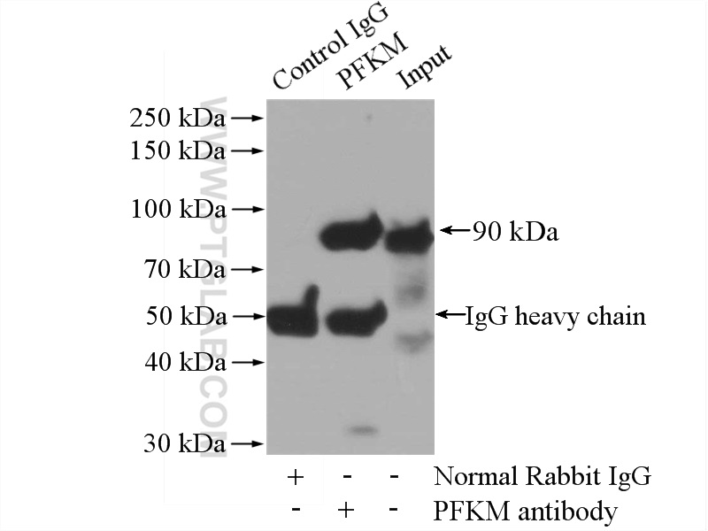 PFKM antibody (55028-1-AP) | Proteintech | 武汉三鹰生物技术有限公司