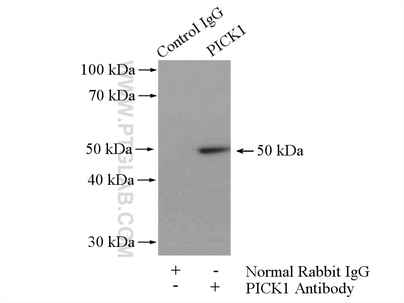 PICK1 antibody (10983-2-AP) | Proteintech | 武汉三鹰生物技术有限公司