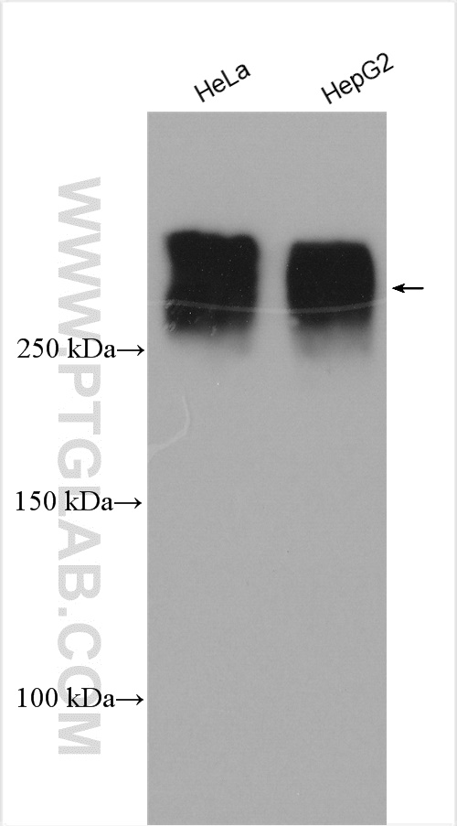 PIEZO1 (extracellular domain) Antibody 28511-1-AP | Proteintech