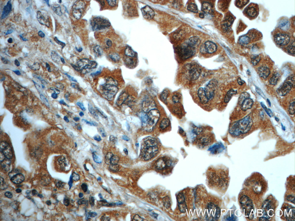 PI3 Kinase p110 Beta Antibody 20584-1-AP | Proteintech
