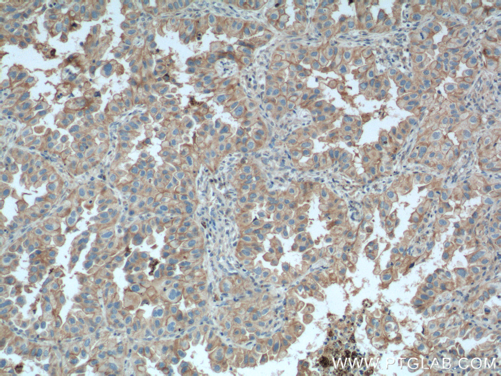 PI3 Kinase p110 Beta Antibody 20584-1-AP | Proteintech