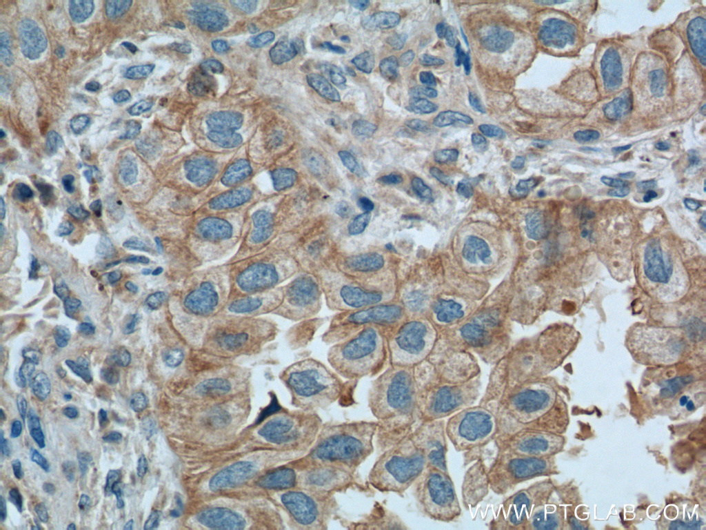 PI3 Kinase p110 Beta Antibody 20584-1-AP | Proteintech