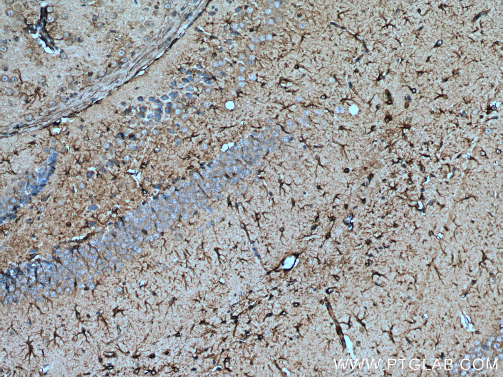 PINK1 antibody (23274-1-AP) | Proteintech