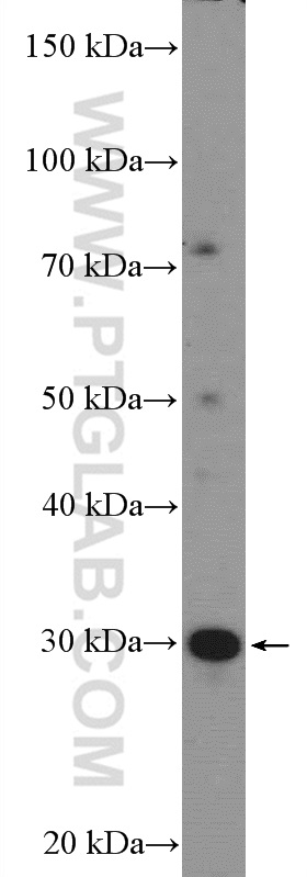 PINK1 antibody (23274-1-AP) | Proteintech