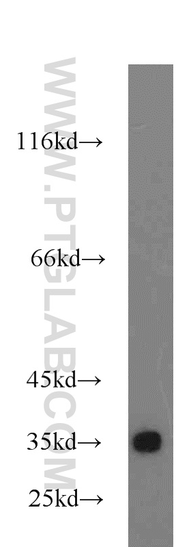 PINK1 antibody (23274-1-AP) | Proteintech